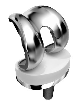 Knee Treatments | Northampton Orthopaedics Surgery & Sports Injuries