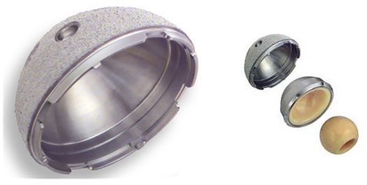 Hip Replacement | Northampton Orthopaedics Surgery & Sports Injuries